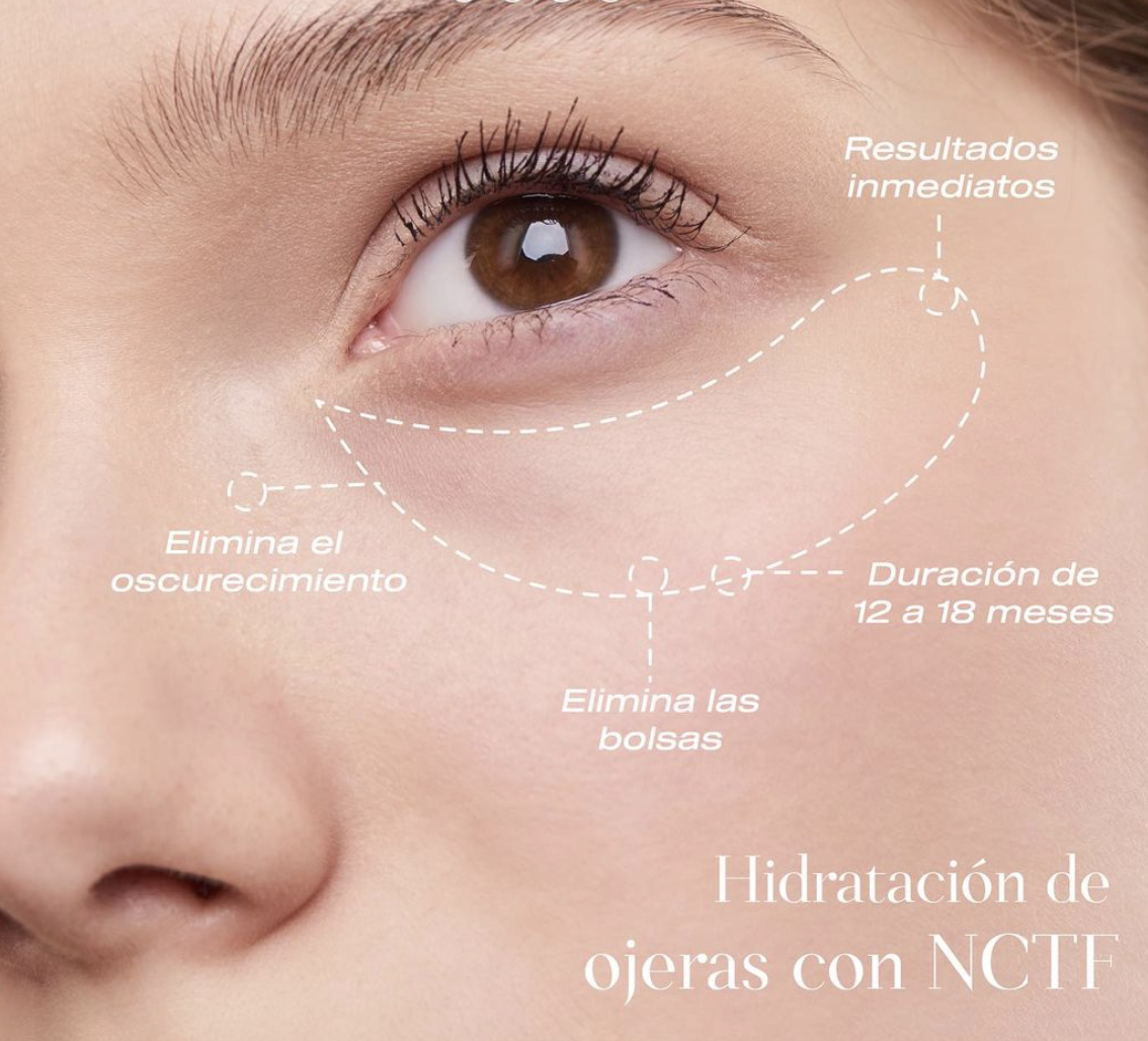 NCTF PERIOCULAR – Glowly